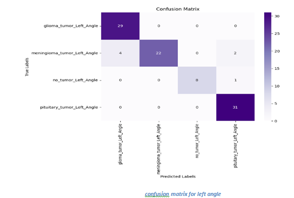 GitHub - ioptime-official/ai-brain-tumor-classification