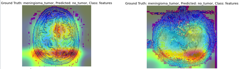 GitHub - ioptime-official/ai-brain-tumor-classification
