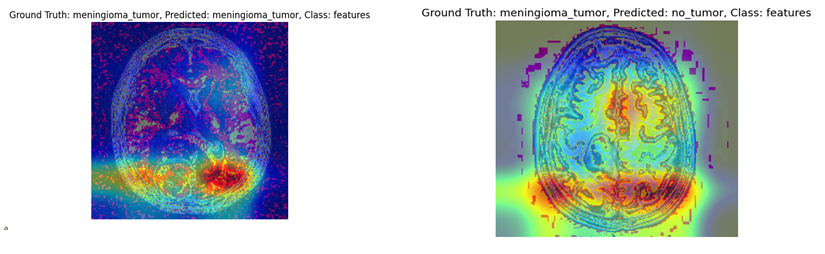 GitHub - ioptime-official/ai-brain-tumor-classification