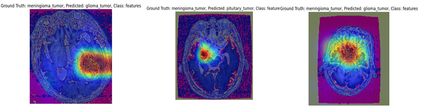 GitHub - ioptime-official/ai-brain-tumor-classification