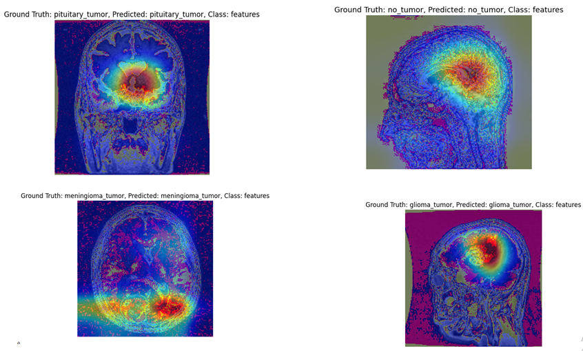 GitHub - ioptime-official/ai-brain-tumor-classification