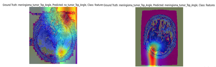 GitHub - ioptime-official/ai-brain-tumor-classification