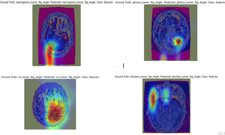 GitHub - ioptime-official/ai-brain-tumor-classification