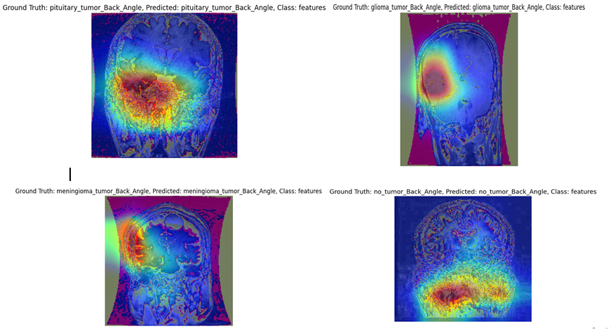 Github Ioptime Official Ai Brain Tumor Classification