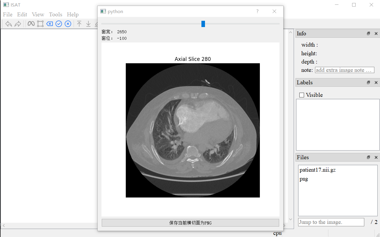 关于医学图像的标注 The medical image annotation issue · Issue #57 · yatengLG/ISAT_with_segment_anything ...