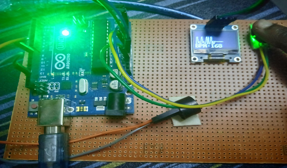 Github Rupamane06heart Attack Detection Using Pulse Sensor The