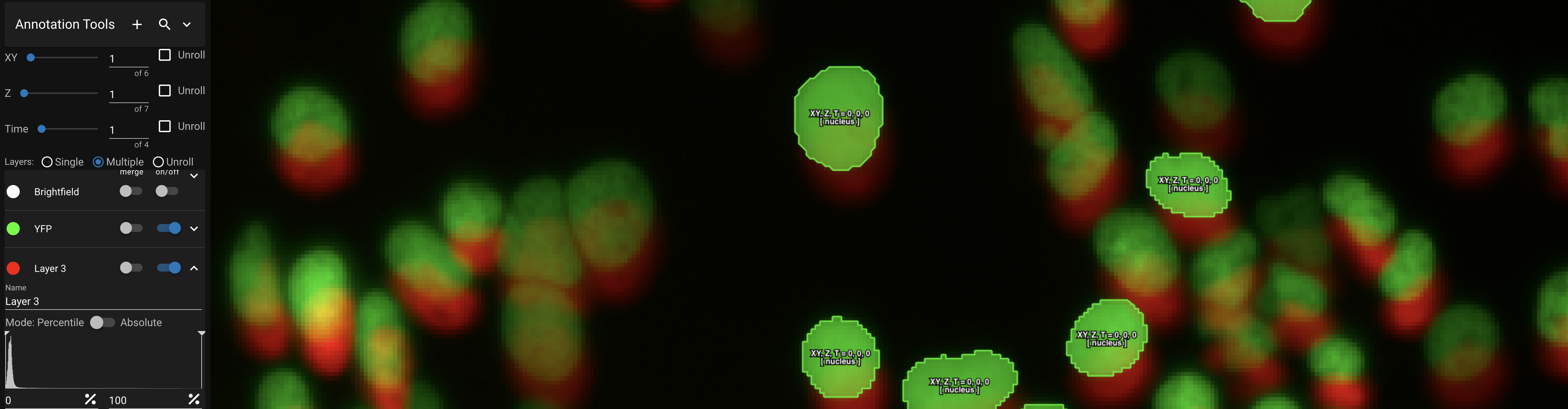 Annotations not showing with time offset · Issue #310 · arjunrajlaboratory/NimbusImage · GitHub