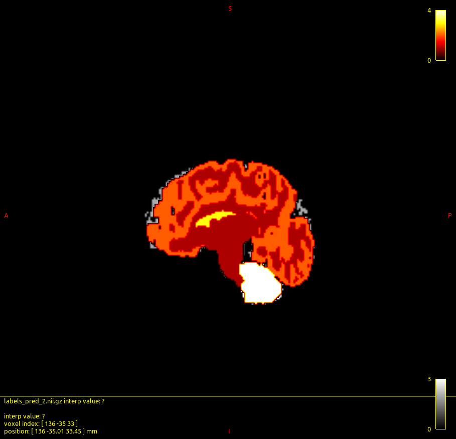 Synthseg+ training · Issue #65 · BBillot/SynthSeg · GitHub
