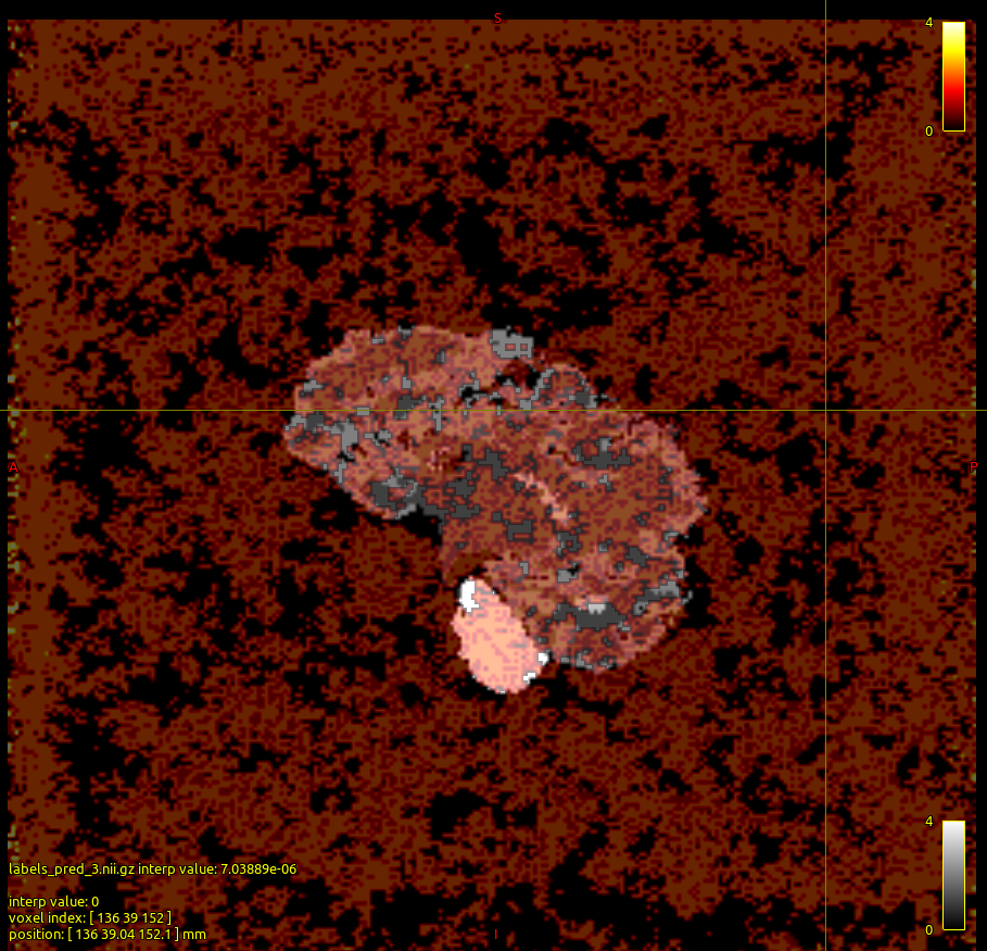 Synthseg+ training · Issue #65 · BBillot/SynthSeg · GitHub