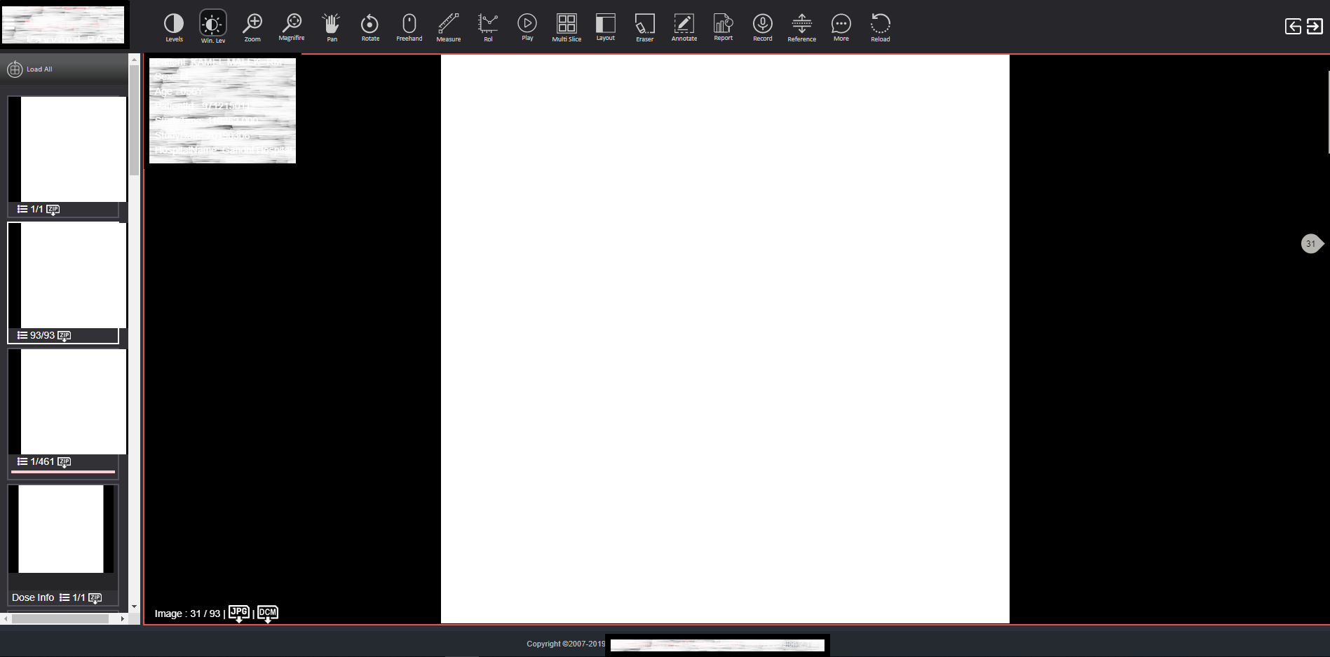 compress a dcm file · Issue #886 · fo-dicom/fo-dicom · GitHub