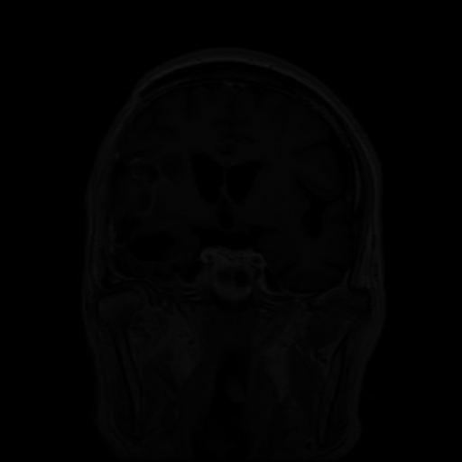 SOF3 encoding support? · Issue #1 · yigolden/JpegLibrary · GitHub