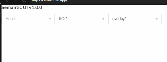 Dropdown value vs. highlighted item inconsistency · Issue #3088 ...