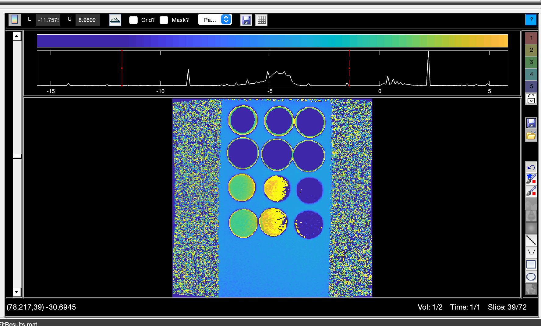 Unrecognised Function or Variable ‘vfa_t1’ · Issue #449 · qMRLab/qMRLab · GitHub