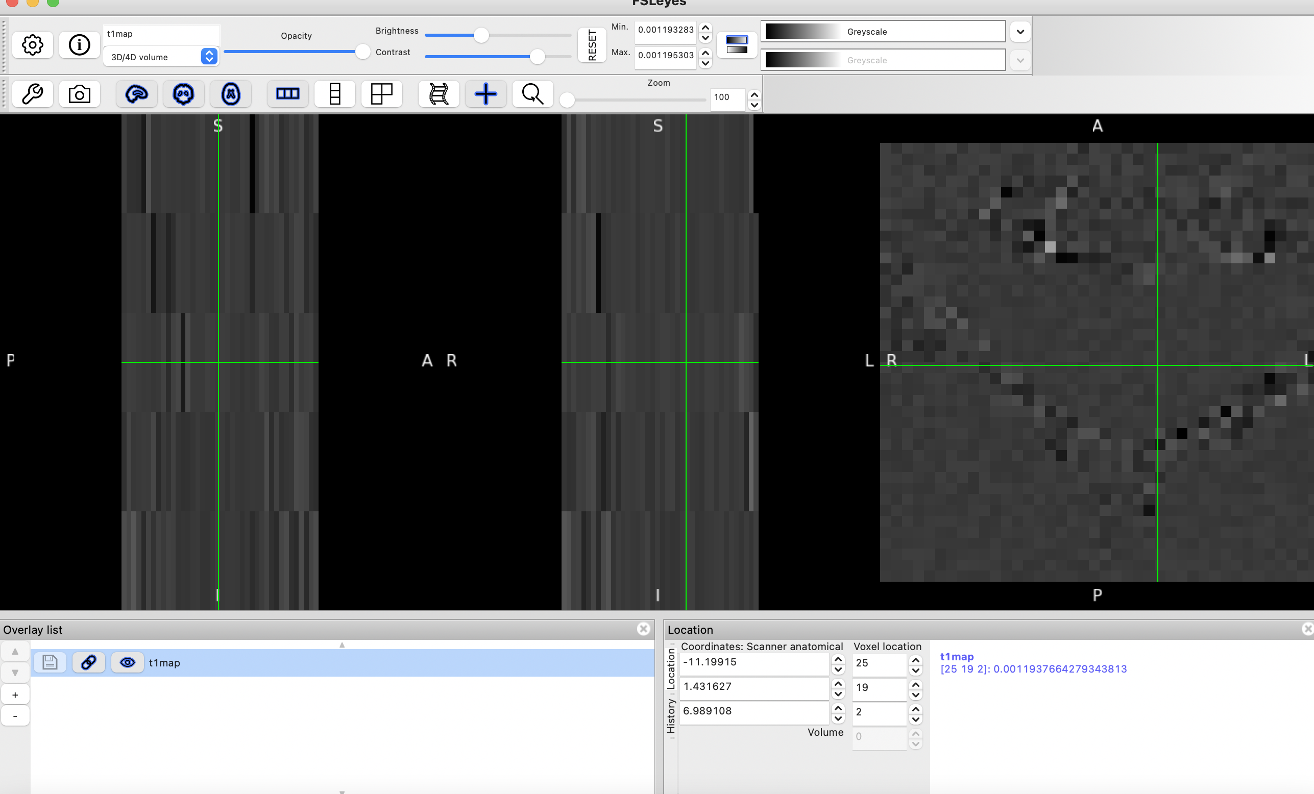 Wrong T1 map · Issue #3810 · spinalcordtoolbox/spinalcordtoolbox · GitHub