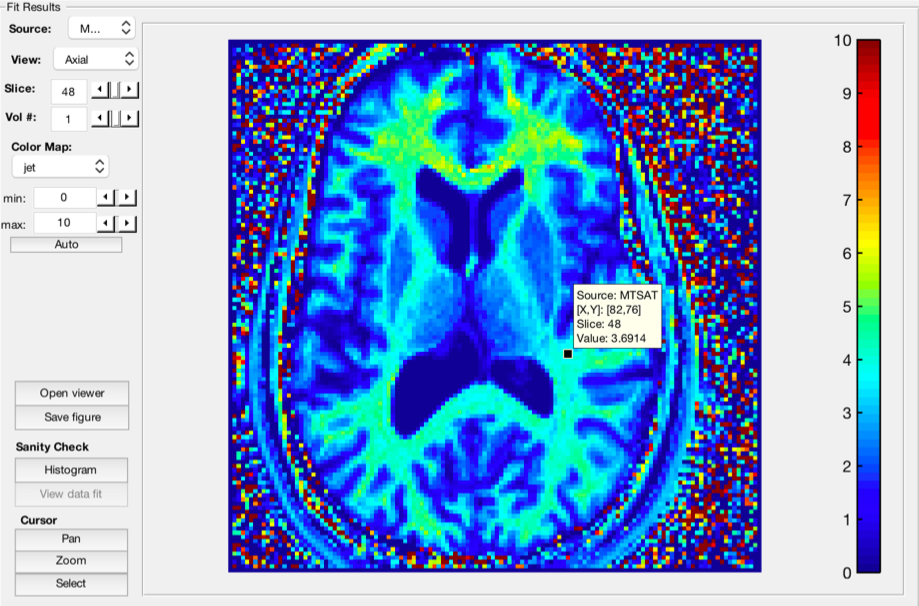 Improve colorbar location & format? · Issue #153 · qMRLab/qMRLab · GitHub