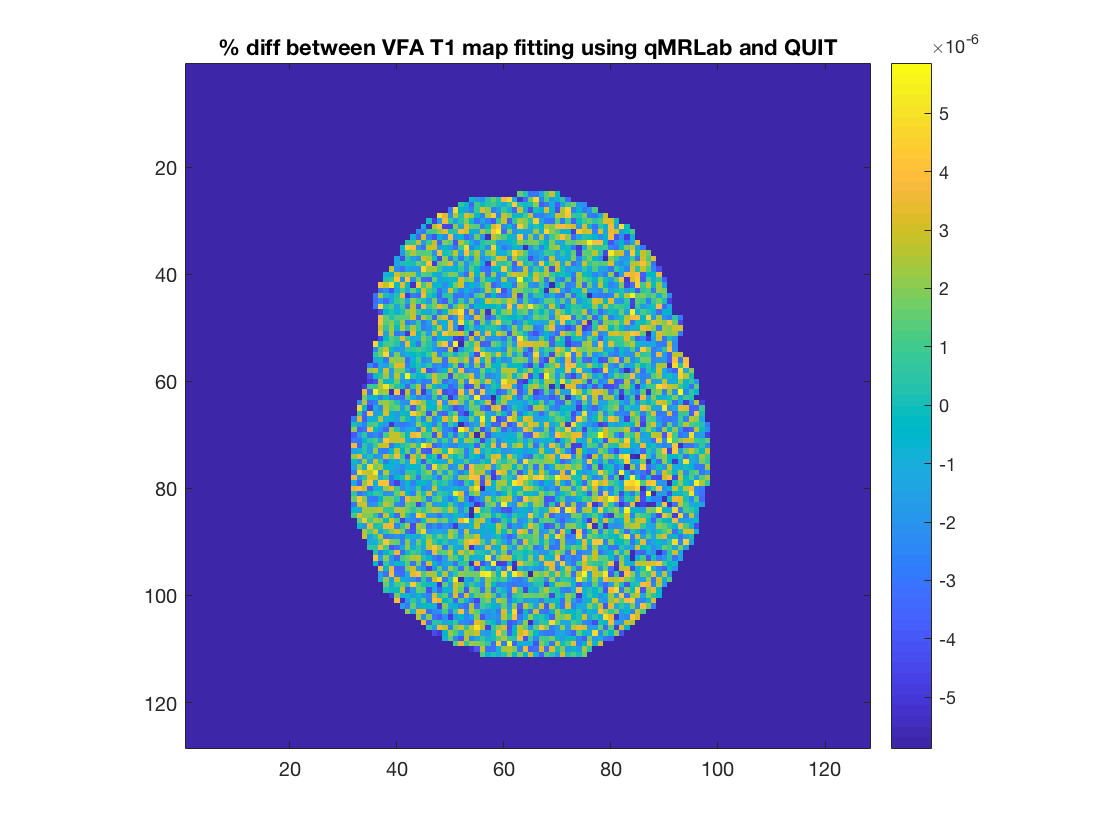 Results of comparing fitted VFA T1 map: qMRLab vs QUIT · Issue #221 · qMRLab/qMRLab · GitHub
