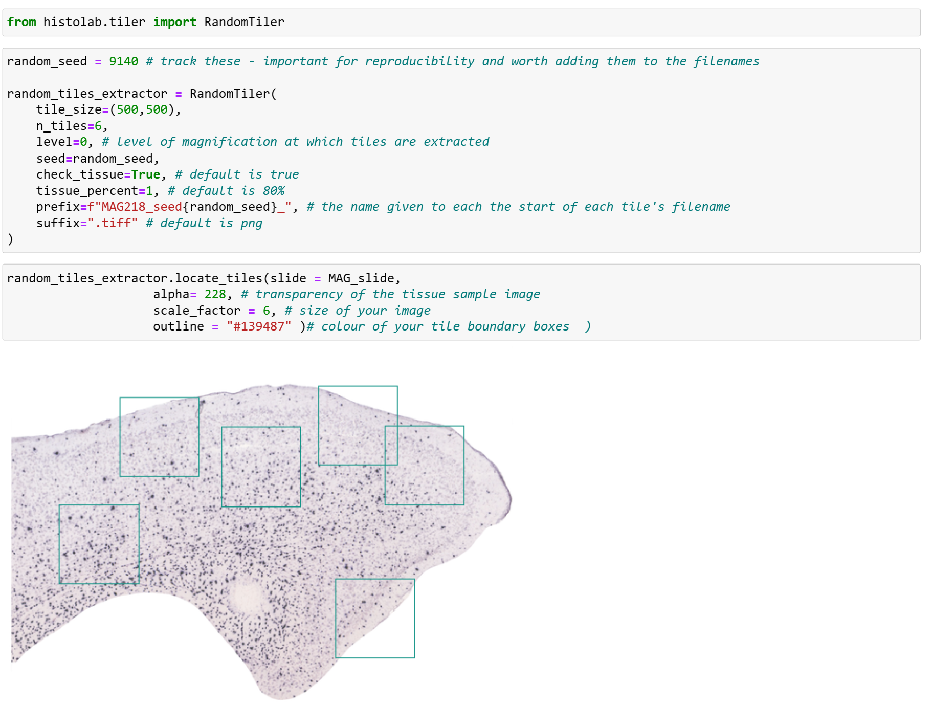 Is there a way to save the locate_tiles output image? · Issue #621 · histolab/histolab · GitHub