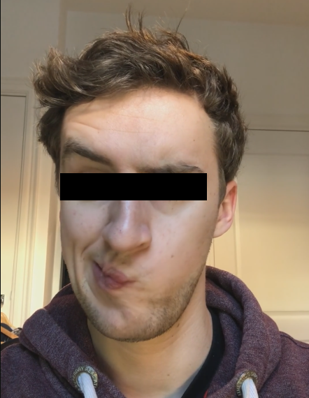 Expression rigging not working as expected · Issue #70 · zhuhao-nju/facescape · GitHub