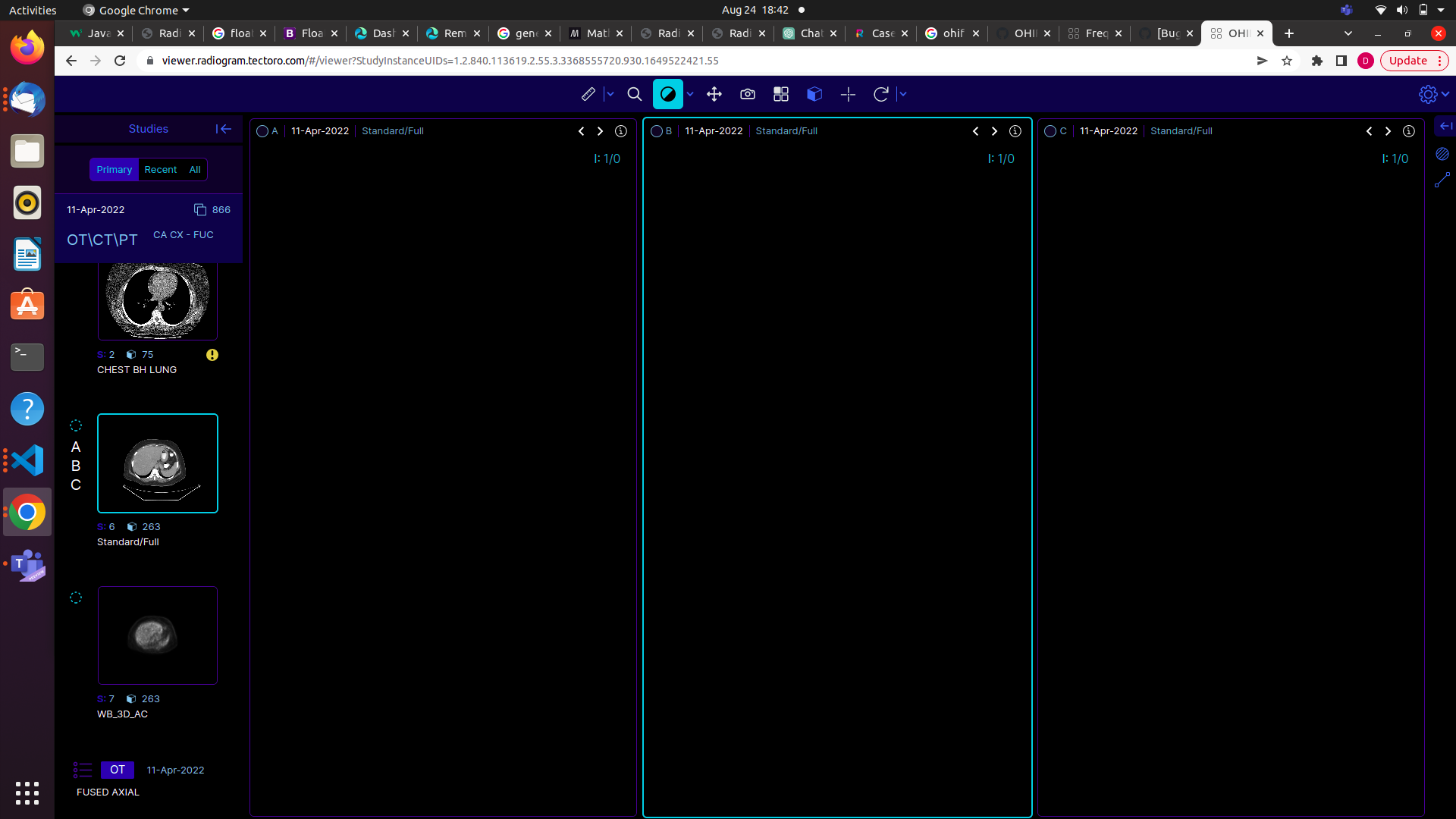 Bug · Issue 3615 · Ohifviewers · Github 