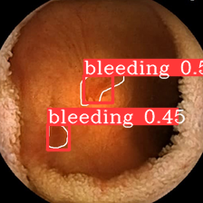 GitHub - Akashkalasagond/Auto-WCEBleedGen-Challenge