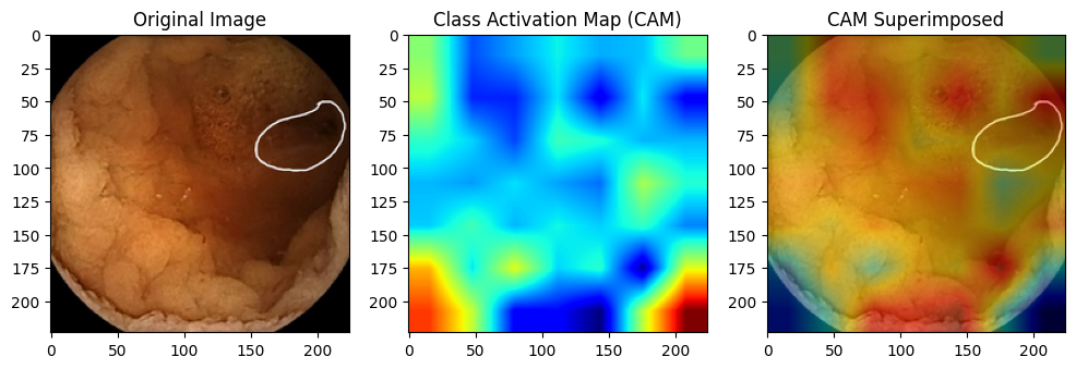 GitHub - Akashkalasagond/Auto-WCEBleedGen-Challenge