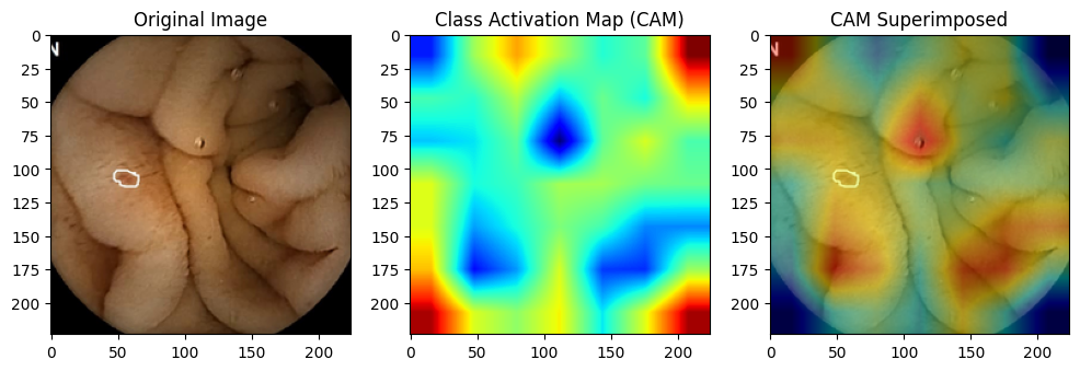 GitHub - Akashkalasagond/Auto-WCEBleedGen-Challenge