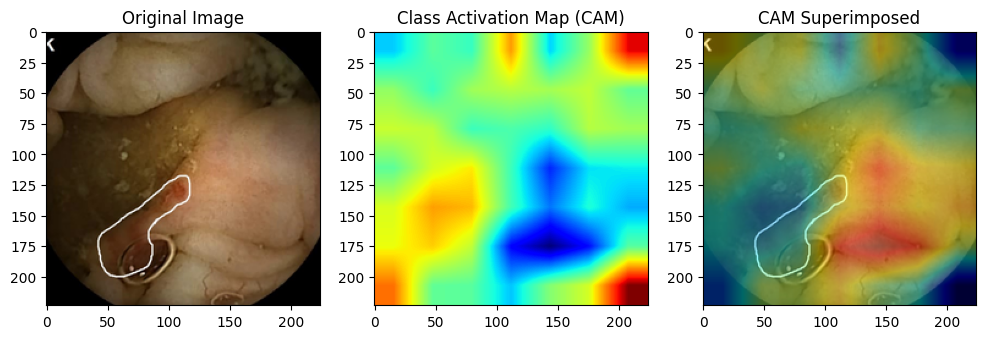 GitHub - Akashkalasagond/Auto-WCEBleedGen-Challenge