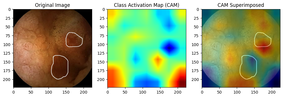 GitHub - Akashkalasagond/Auto-WCEBleedGen-Challenge