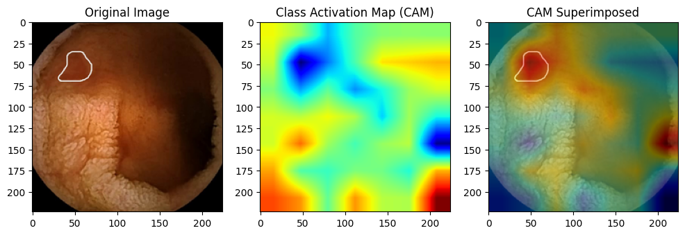 GitHub - Akashkalasagond/Auto-WCEBleedGen-Challenge