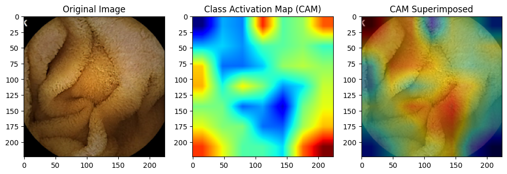 GitHub - Akashkalasagond/Auto-WCEBleedGen-Challenge