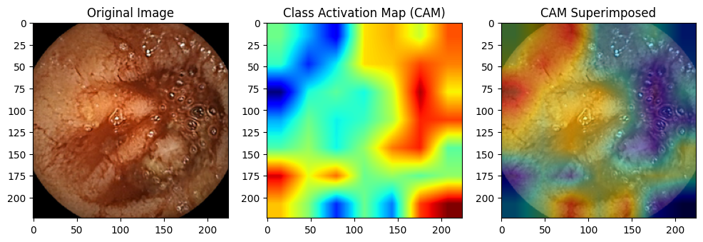 GitHub - Akashkalasagond/Auto-WCEBleedGen-Challenge