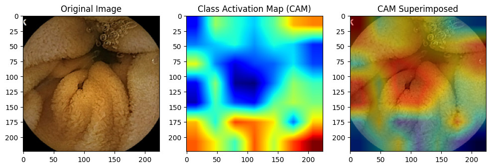 GitHub - Akashkalasagond/Auto-WCEBleedGen-Challenge