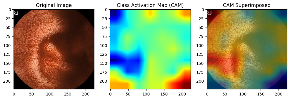 GitHub - Akashkalasagond/Auto-WCEBleedGen-Challenge