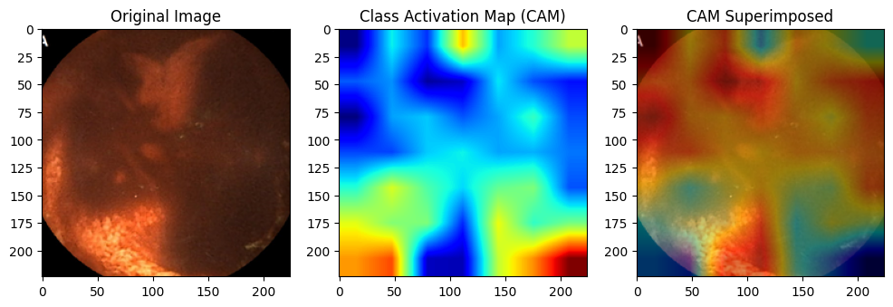 GitHub - Akashkalasagond/Auto-WCEBleedGen-Challenge