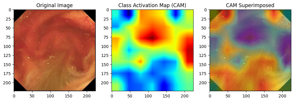 GitHub - Akashkalasagond/Auto-WCEBleedGen-Challenge