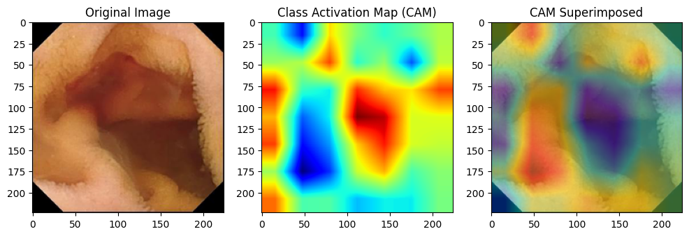 GitHub - Akashkalasagond/Auto-WCEBleedGen-Challenge