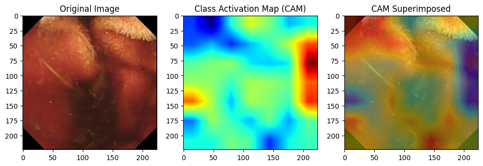 GitHub - Akashkalasagond/Auto-WCEBleedGen-Challenge