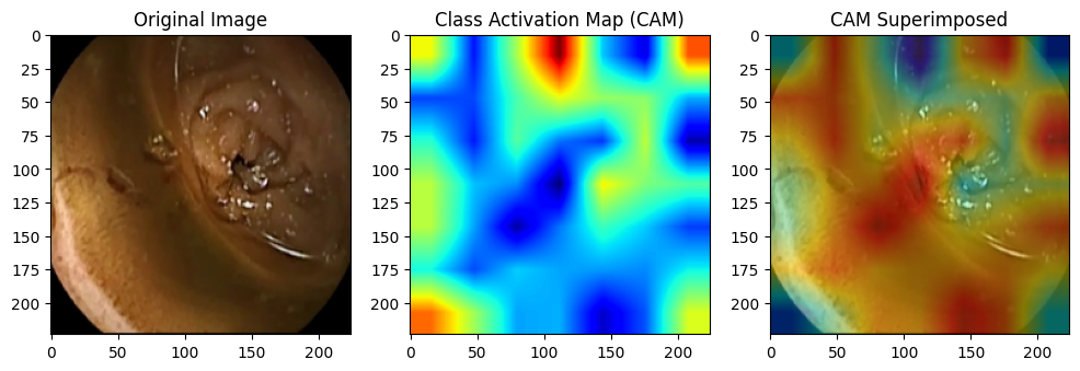 GitHub - Akashkalasagond/Auto-WCEBleedGen-Challenge