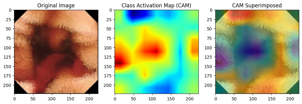 GitHub - Akashkalasagond/Auto-WCEBleedGen-Challenge