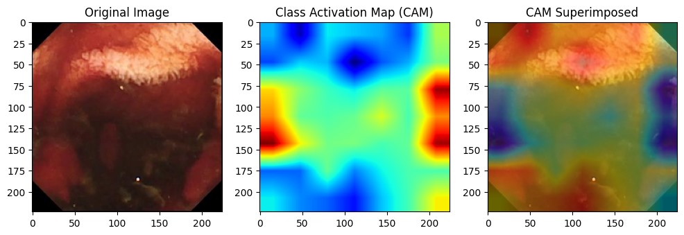 GitHub - Akashkalasagond/Auto-WCEBleedGen-Challenge