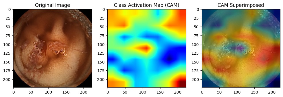 GitHub - Akashkalasagond/Auto-WCEBleedGen-Challenge