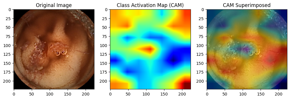 GitHub - Akashkalasagond/Auto-WCEBleedGen-Challenge