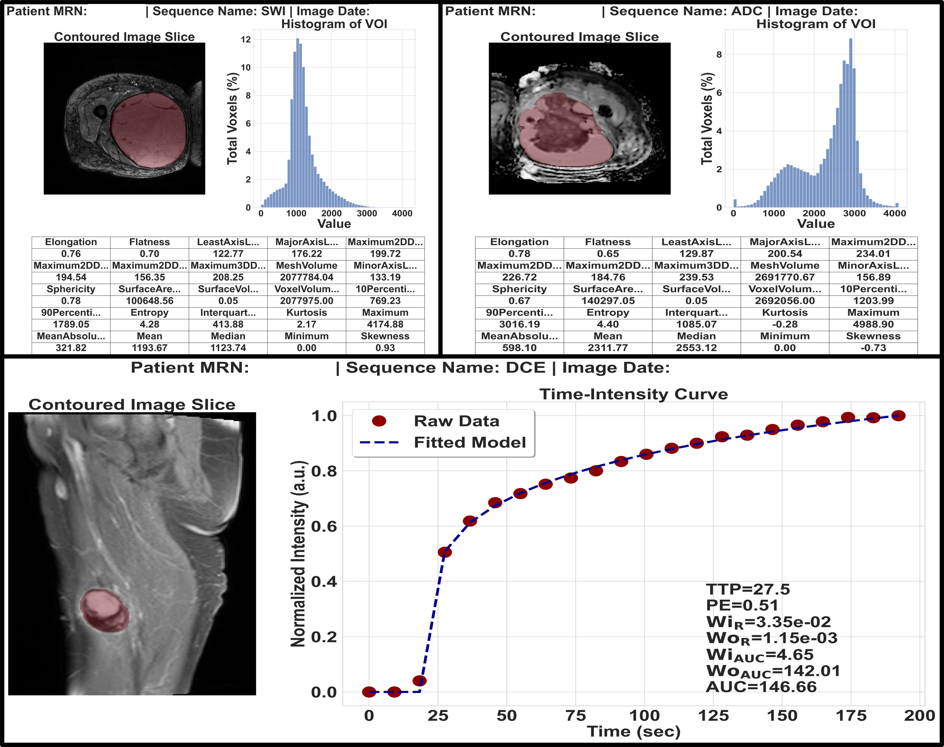 GitHub - ABASTI-Lab/CARPI: The Cancer Radiomic and Perfusion Imaging ...
