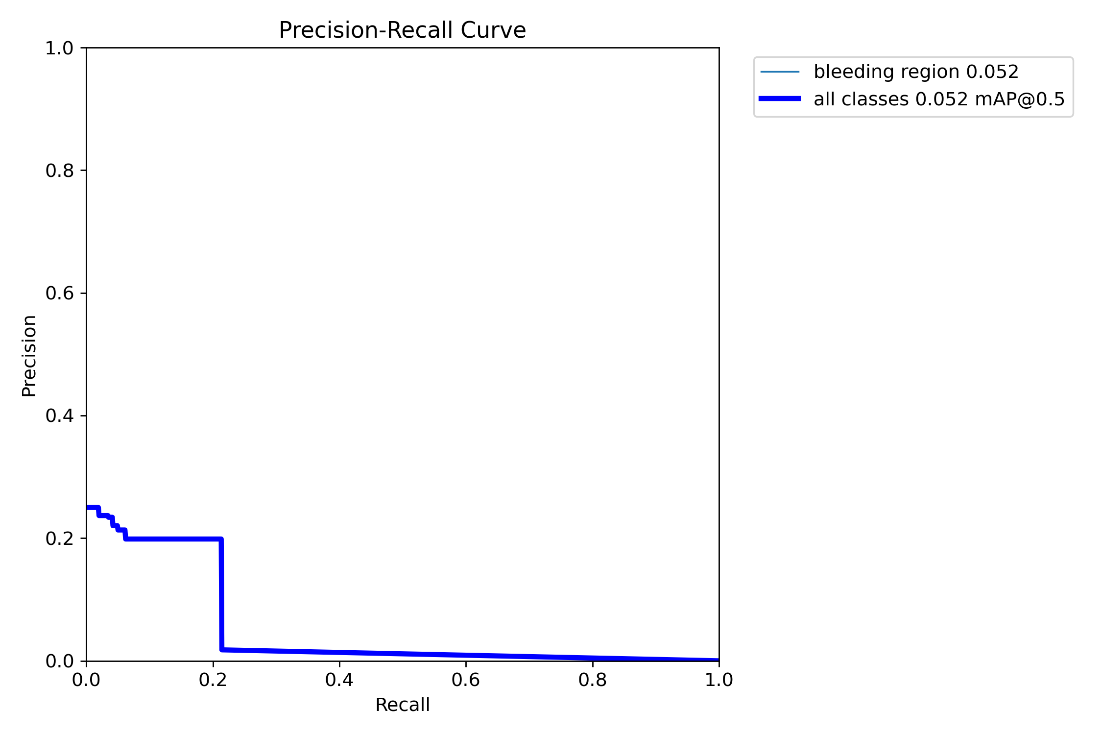GitHub - PhilipWinston/Auto-WCEBleedGen