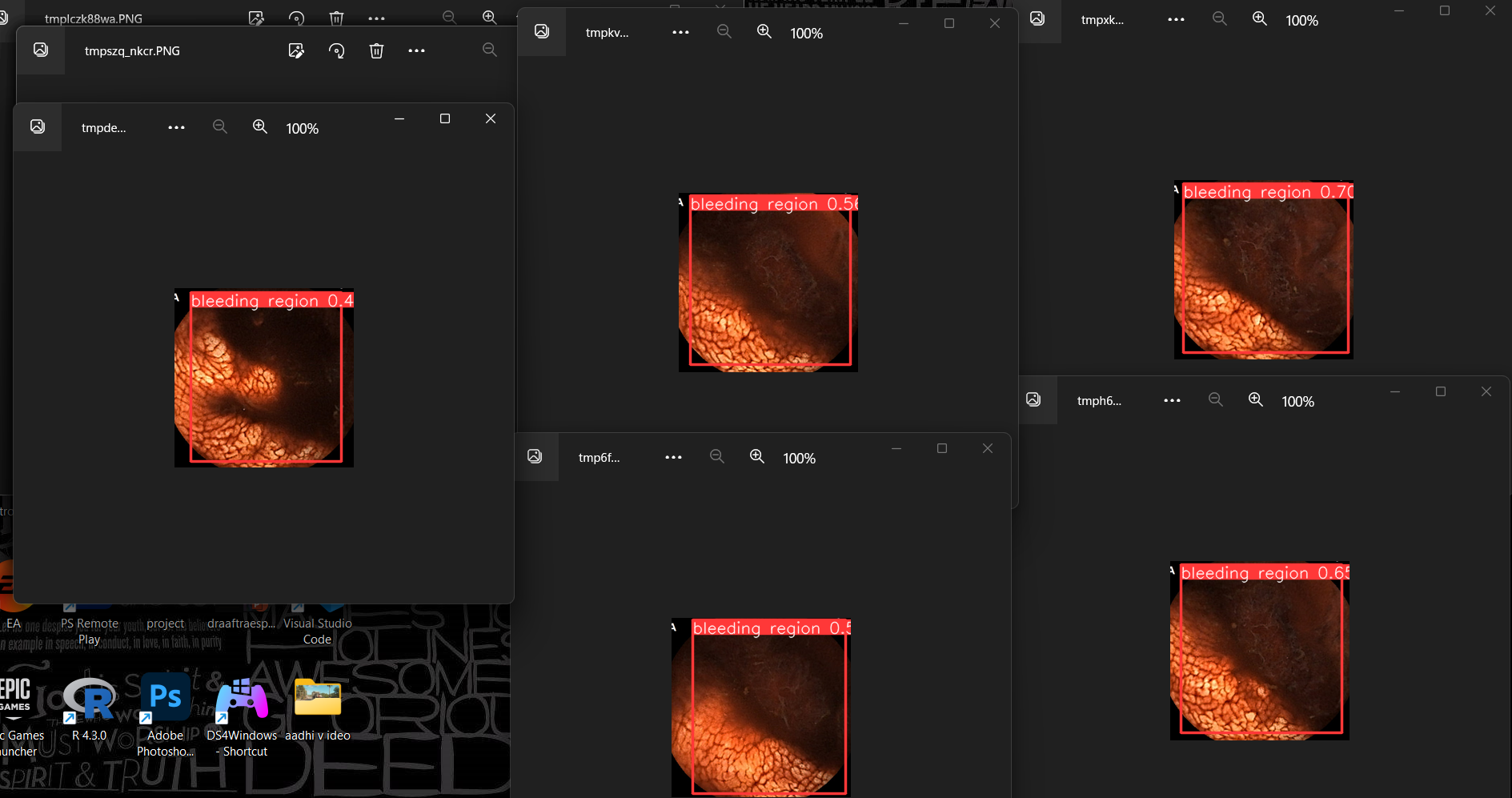 GitHub - PhilipWinston/Auto-WCEBleedGen