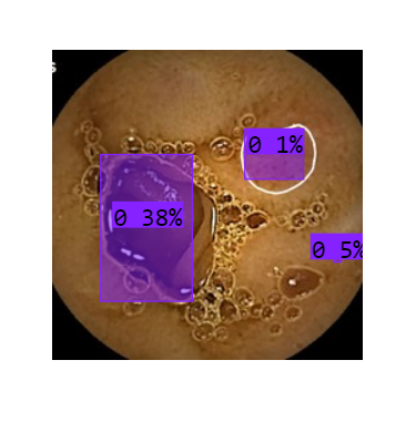 GitHub - ATHdevs/Auto-WCEBleedGen-Challenge