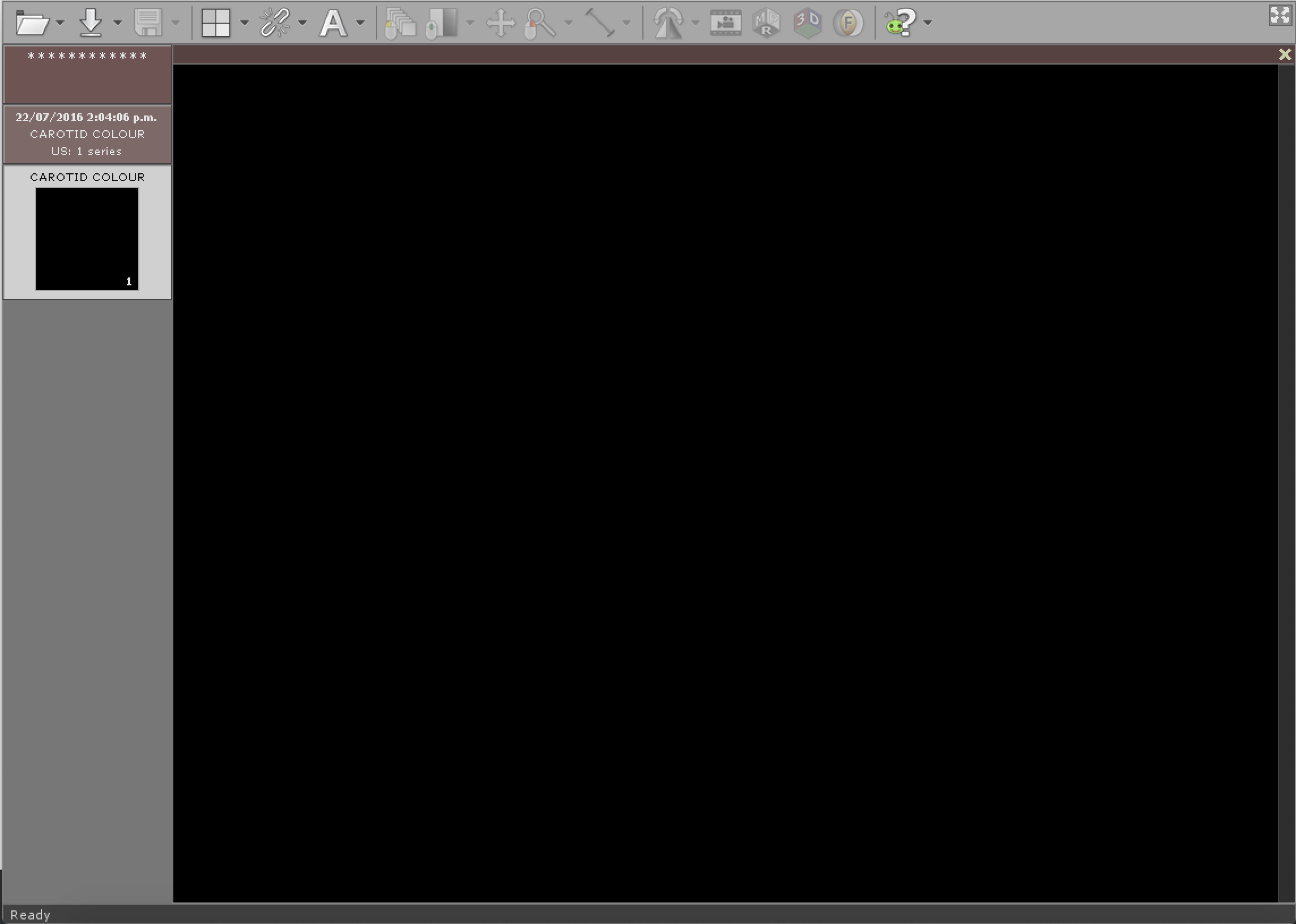 Anonymize Pixel Data In Dicom Images · Issue #120 · cornerstonejs/dicomParser · GitHub