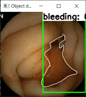 GitHub - TeamUltF4/WCEBleedgen_tensor