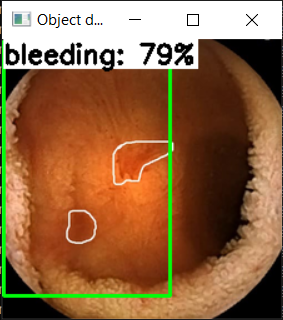 GitHub - TeamUltF4/WCEBleedgen_tensor