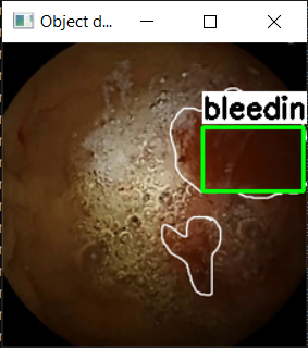 GitHub - TeamUltF4/WCEBleedgen_tensor